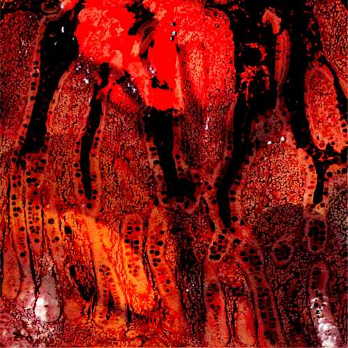 Spewn / Medicine Noose - Medicine Noose / Spewn - Encyclopaedia ... Spewn / Medicine Noose - Medicine Noose / Spewn - Encyclopaedia ...